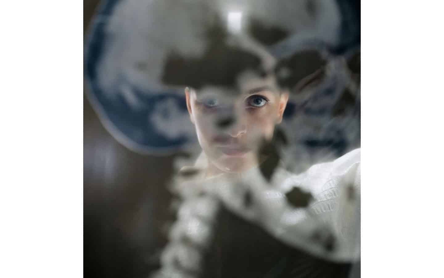 Imaging Reports Understood – Centurion Physical Therapy